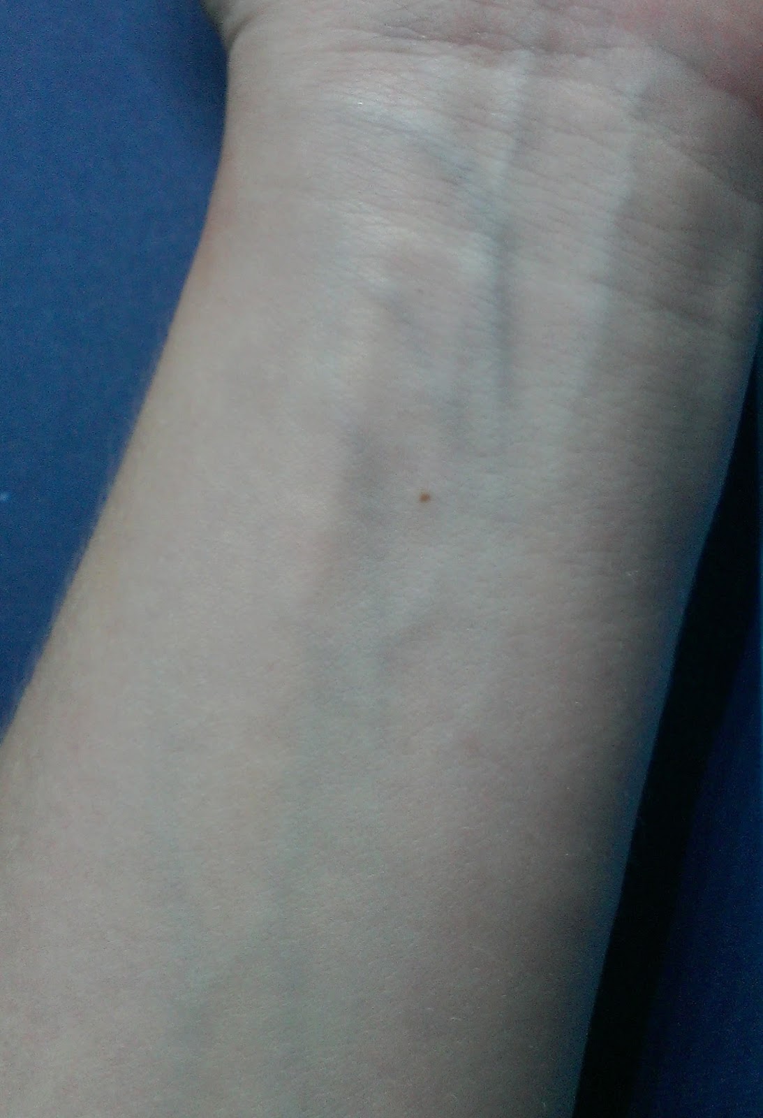 CreepyVel - the blog of creepy beauty: Open wound with stitches ...