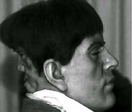 O INEXPLICAVEL: O HOMEM DE DUAS FACES