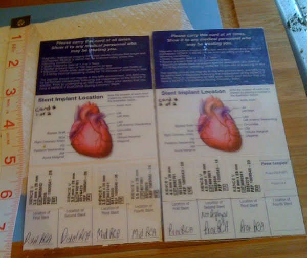 A Change of Heart: Life Post-Dissection and Heart Attack