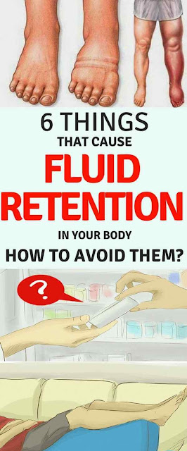 Daily Health Advisor : 6 Things That Cause Fluid Retention in Your Body ...