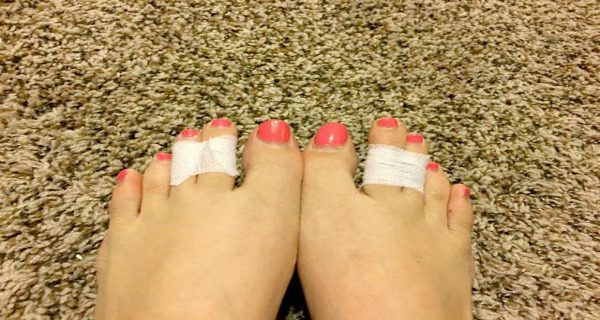 So Many Women Now Tape Their Middle Toes Together, And You’ll Want To ...
