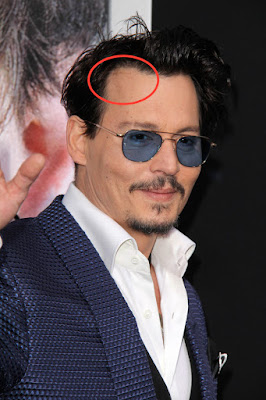 Celebrity Hair Loss: Johnny Depp Goes Bald for "Black Mass"
