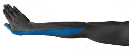ARES Kinesiology Tape: Thumb Tendinitis