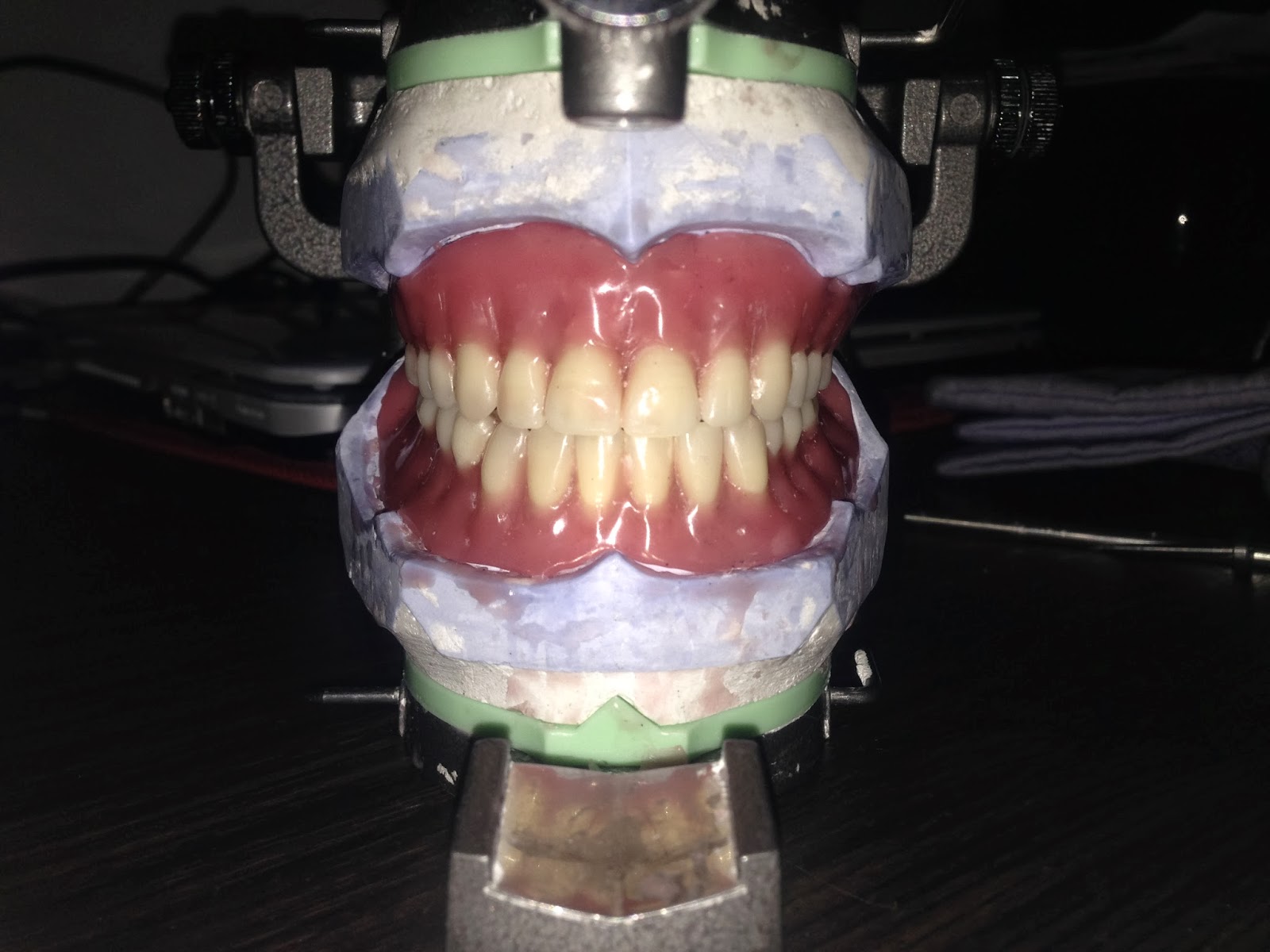 The Journal: Prosthodontic