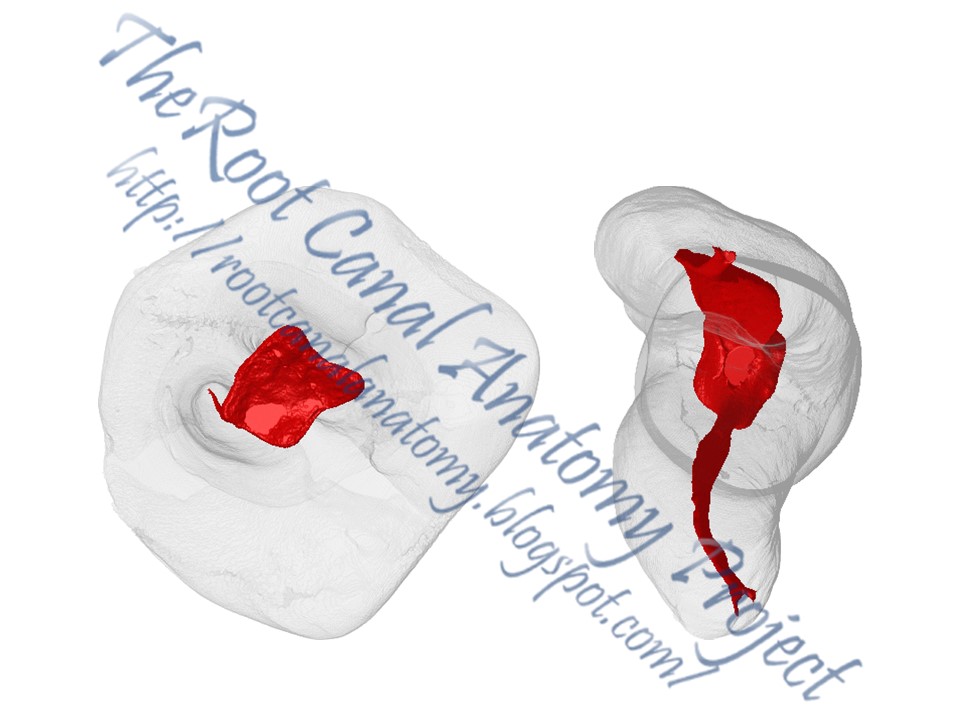 The Root Canal Anatomy Project: Mandibular Second Molar