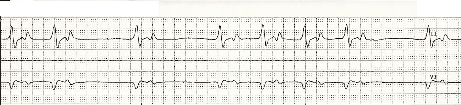 For in that sleep of death what dreams may come...