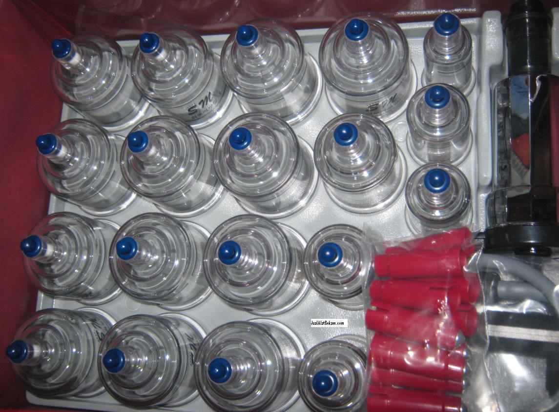 Peralatan berbekam diperlukan untuk disterilkan