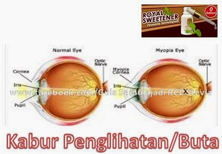 Royal Sweetener Stevia Gula Semulajadi: Kesan Penyakit Kencing Manis ...