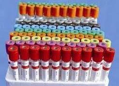 Distributor Alat Kesehatan & Medical Disposable: Vacutainer Sebagai ...