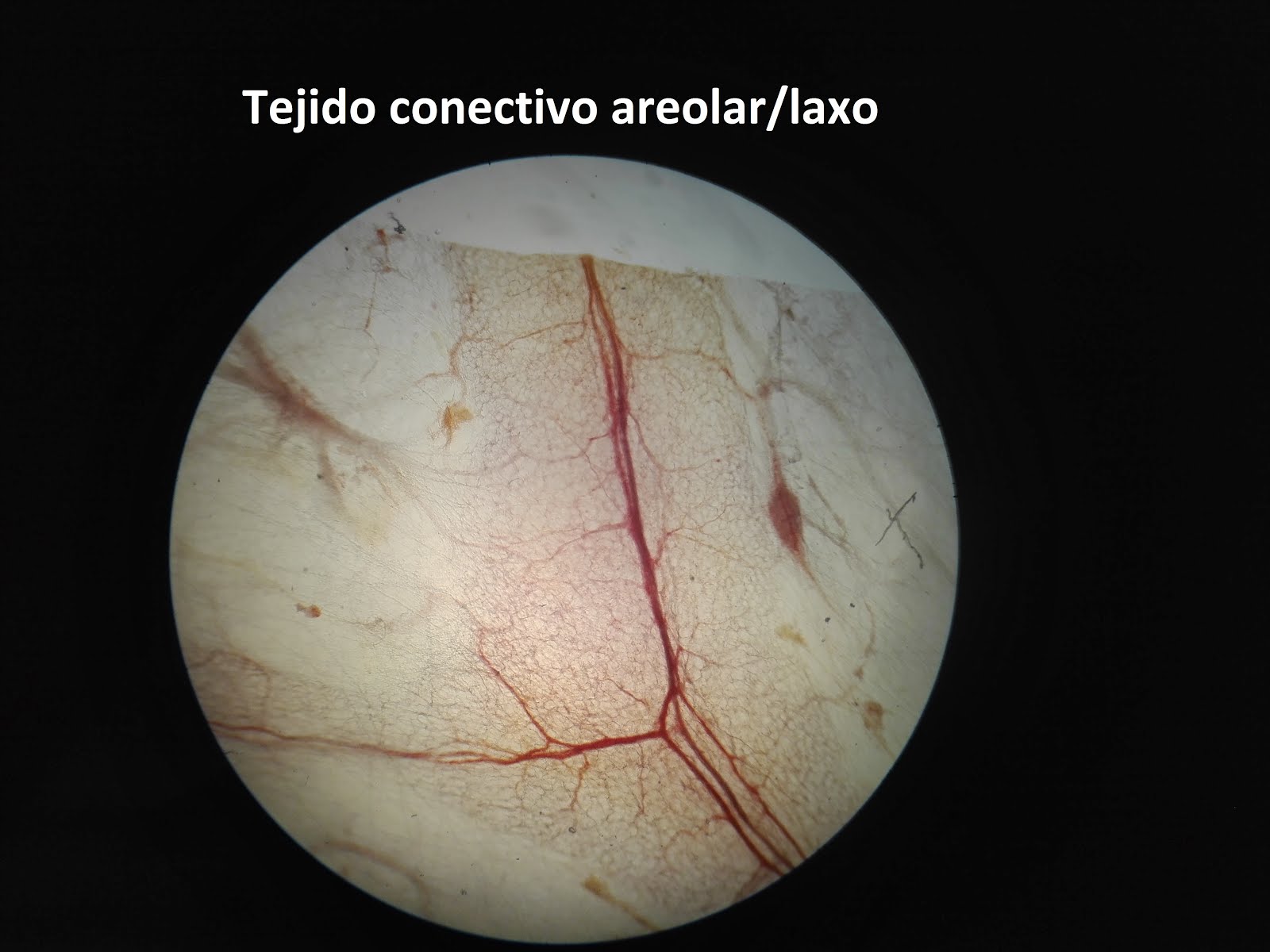 Neo médico : Tejido conectivo - Imagenes histologicas (Microscopicas)