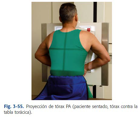 PRODUCCION Y TRATAMIENTO DE IMAGENES DIAGNOSTICAS: CAPITULO TORAX