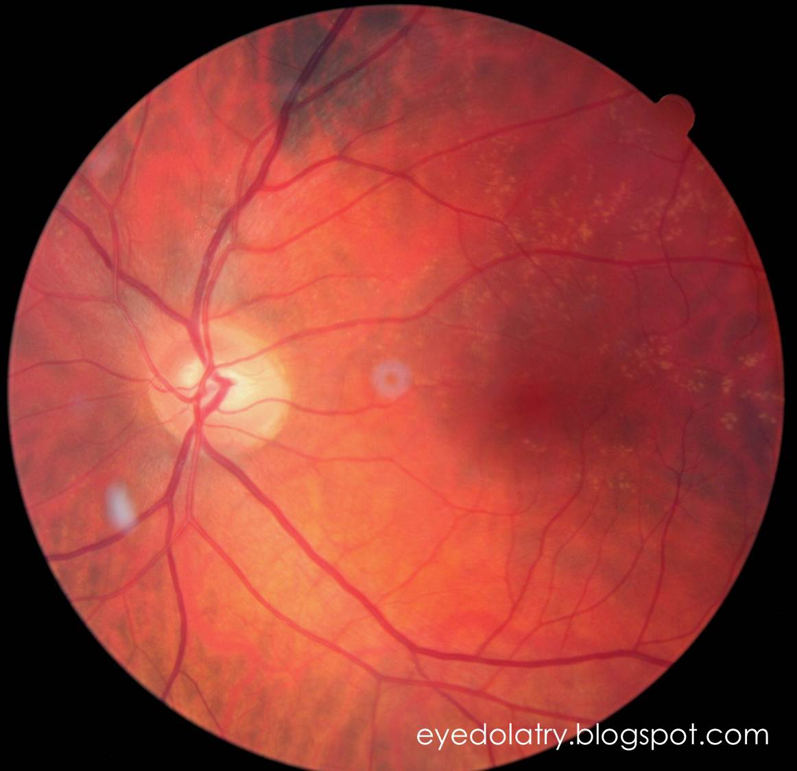 IMAGES - Eyedolatry