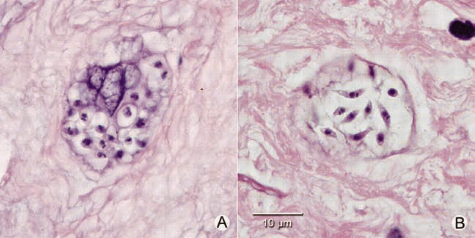 fichero hematologia: Amastigote