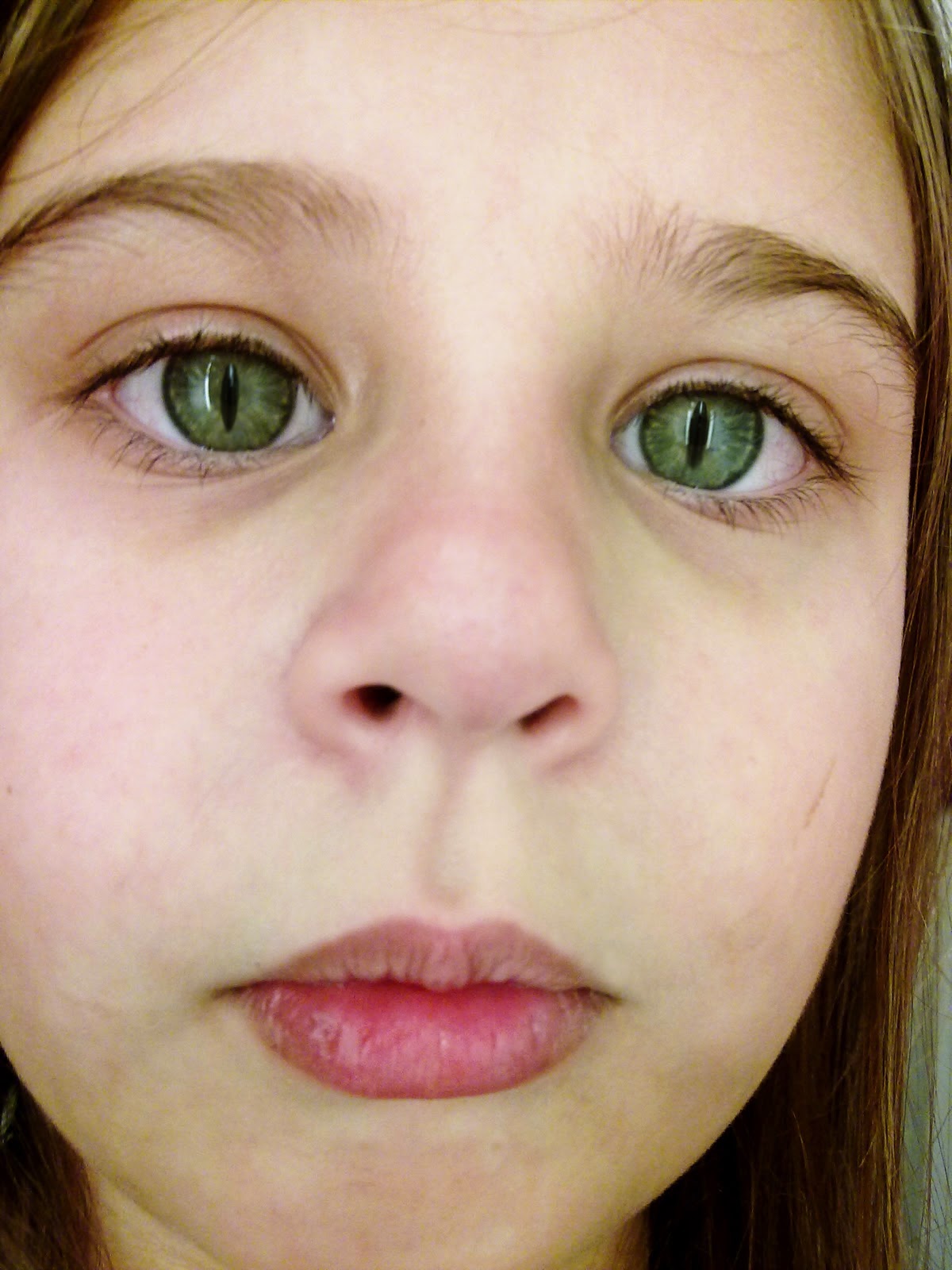 Síndrome de Coloboma o pupilas de gato - Taringa!