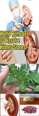 Health Booster: NATURAL REMEDIES TO DISSOLVE KIDNEY STONES