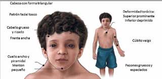 GENÉTICA: El síndrome Leopard