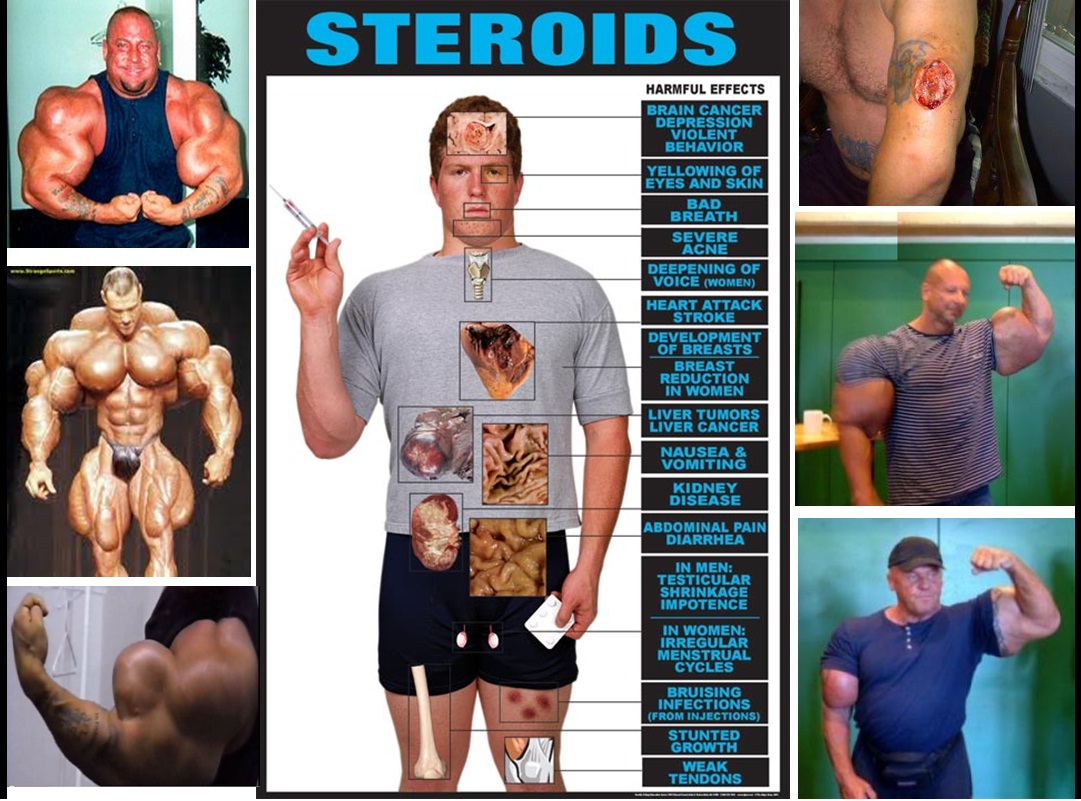 My Protein Shop: Side Effect Of Steriod!