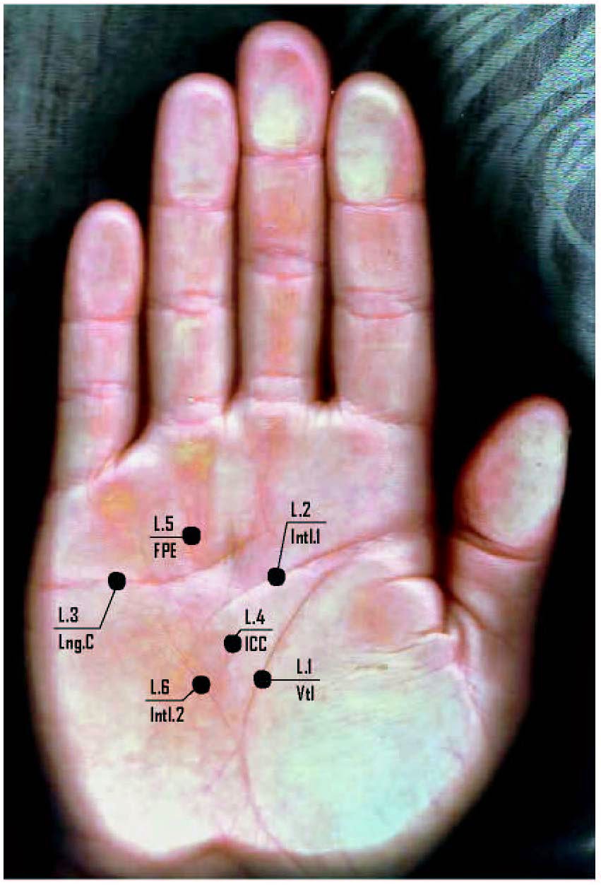 Quiografía por Escaner