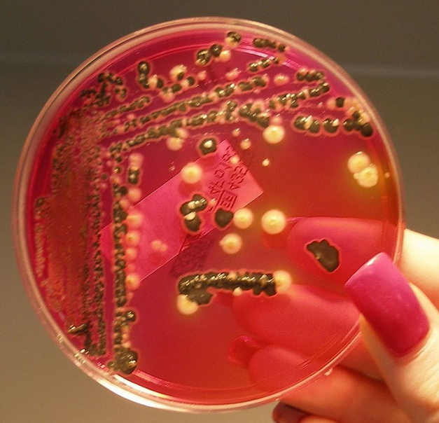 Infeksi Salmonella Paratyphi | TES DARAH LENGKAP