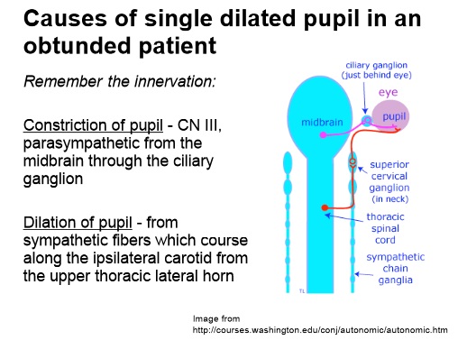 THE A.D.D. E.D.: the blown pupil