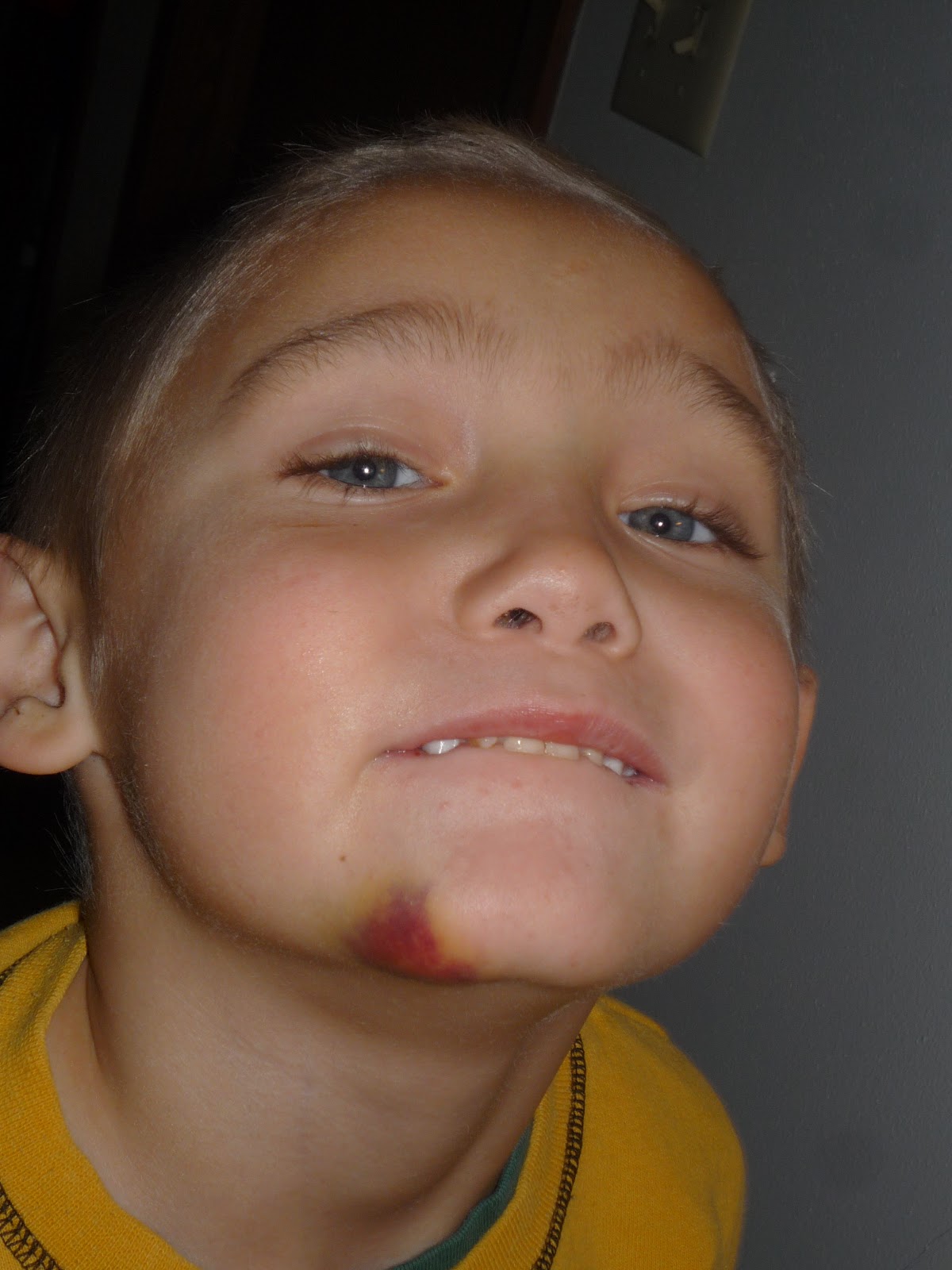 Another Link in the McChain