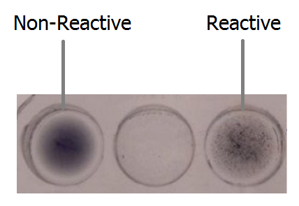 mltshiksha.blogspot.com: VDRL/RPR Test