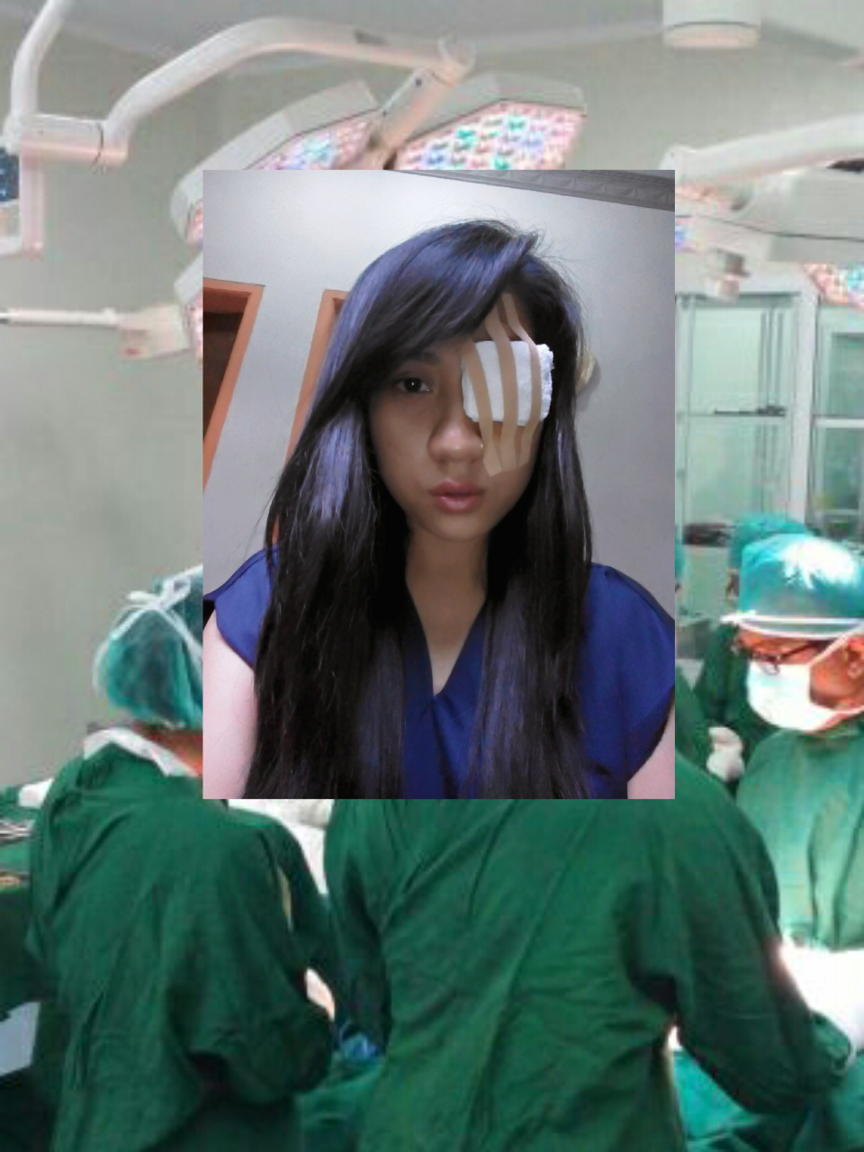 Nuris Dian Anggraini: OPERASI KALAZION