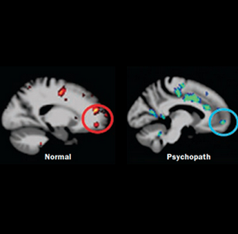 More Brain Points: The Brain of a Psychopath