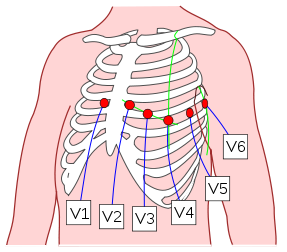 Derivaciones cardiacas del Electrocardiograma: LO BASICO Y SIMPLE DEL E K G