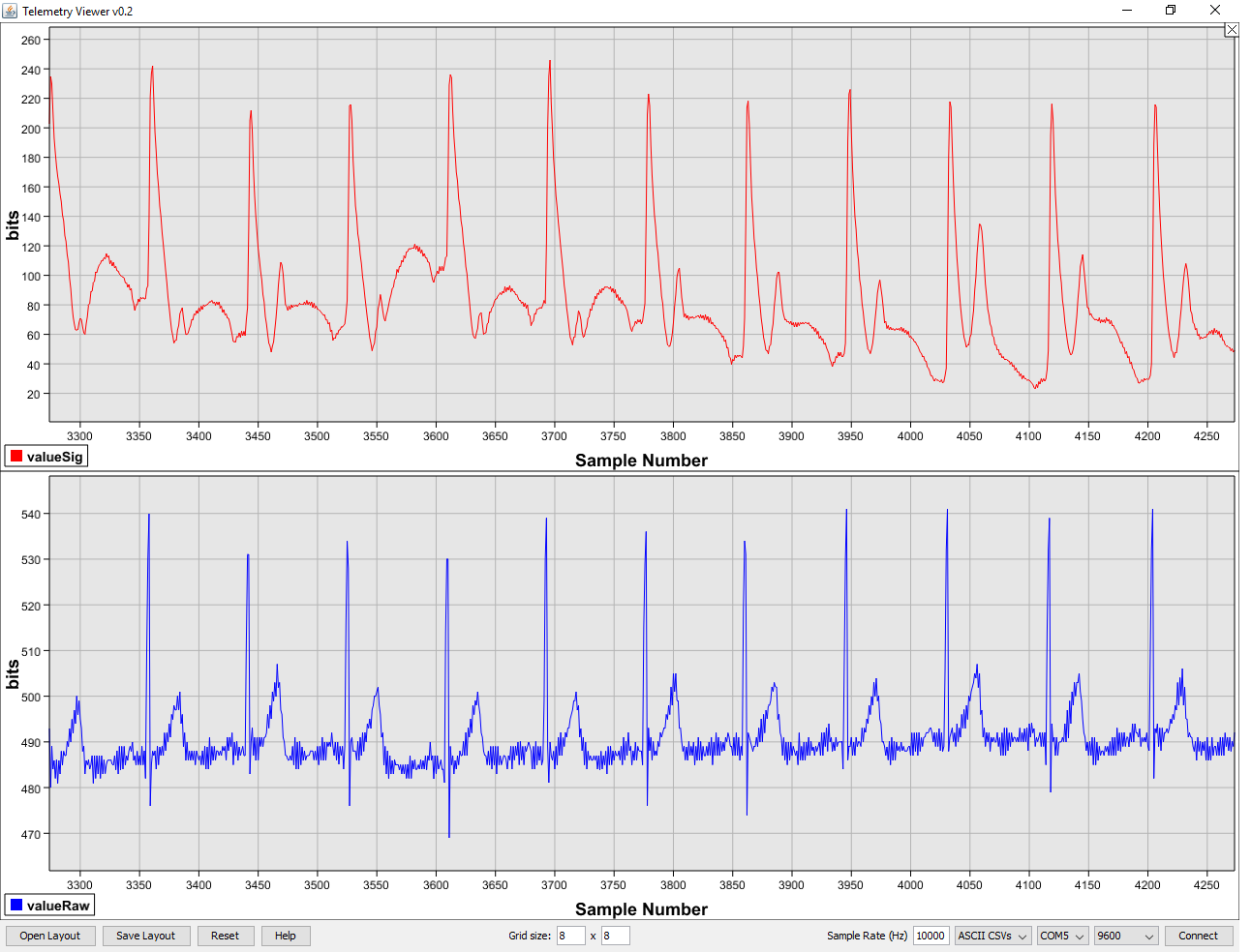 The Answer is 42!!: Myoware muscle sensor circuits from Sparkfun and ...
