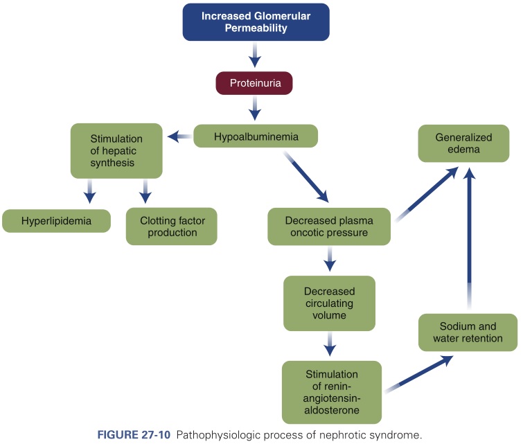 Hospital Student: NEPHROTIC SYNDROME