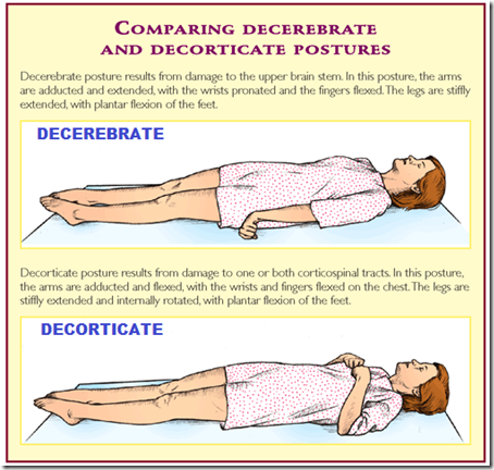 SRNA Daily Review: DERMATOMES & GLASGOW COMA SCALE