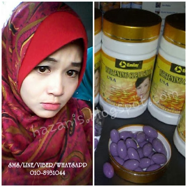 Review : Emilay Whitening Clear Spots USA - ! Love Is Cinta