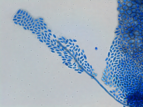 Fun With Microbiology (What's Buggin' You?): Exophiala dermatitidis