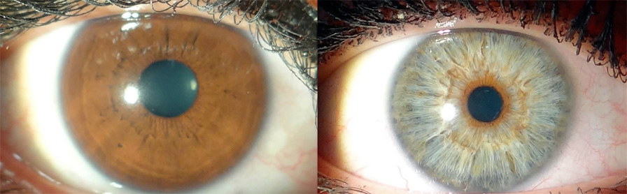 Blog do Guih: Biokinesis, Funciona?