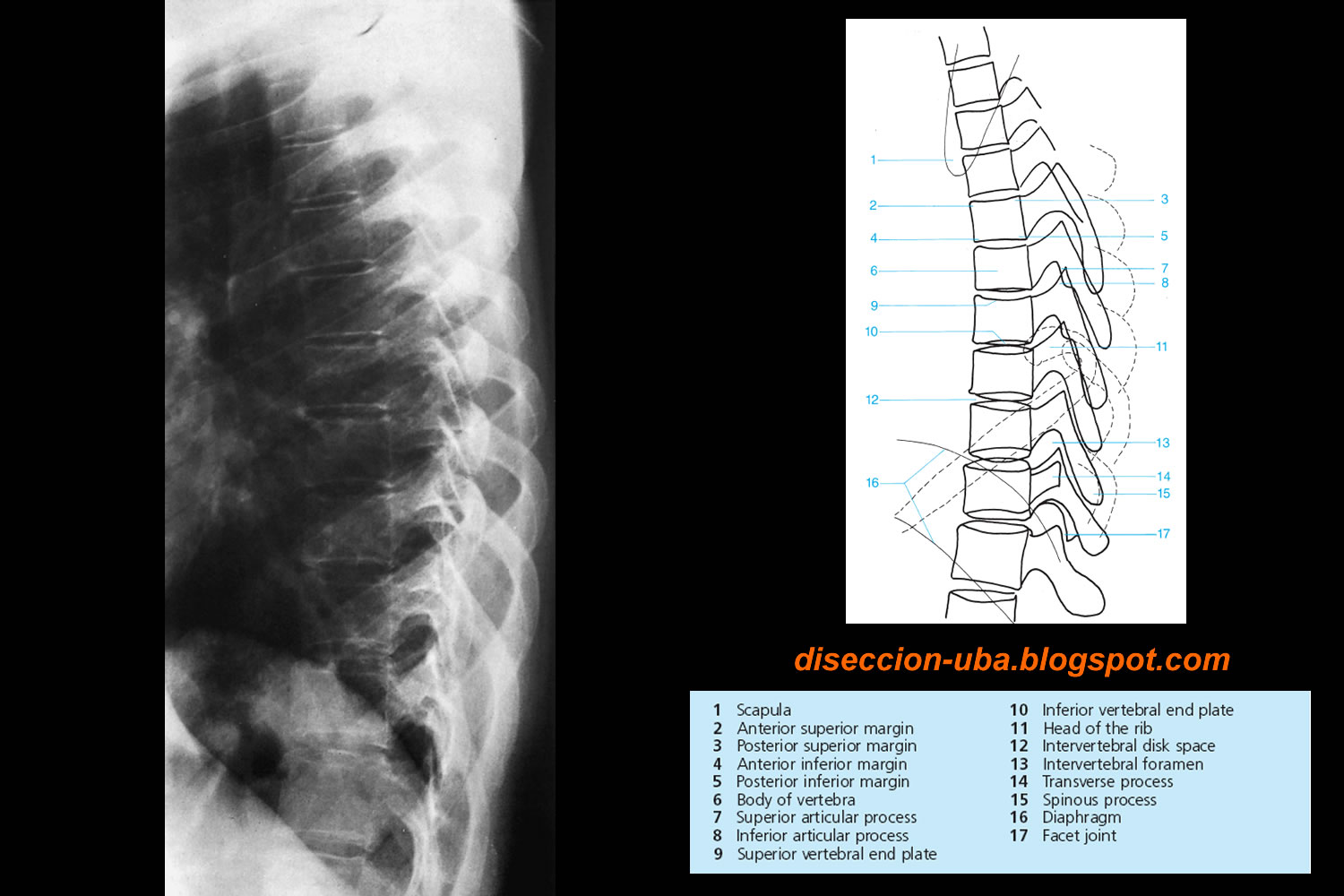 Radiografia De Coluna Toracica Ap Lateral - RETOEDU