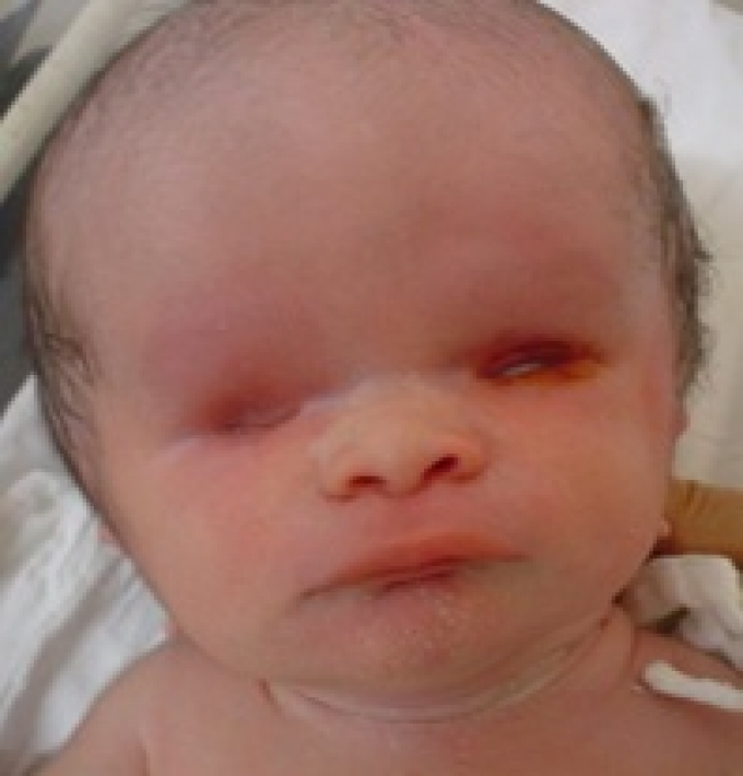 LA VISION Y SUS DIMENSIONES : 2017