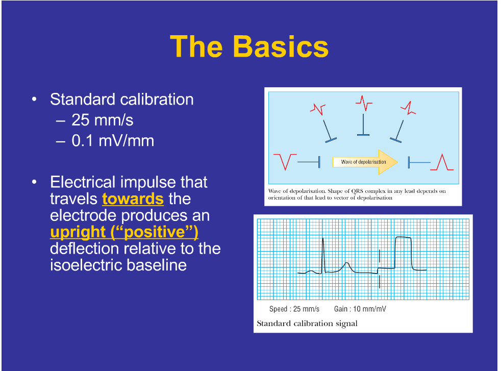 World's Tragic In Medlife,.....You May Know Or Not: ECG TUTORIAL