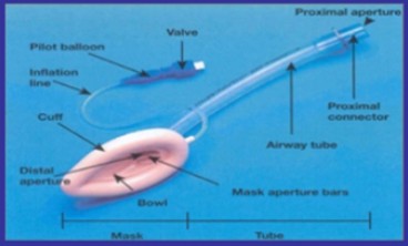 Anestesi Ivan Atjeh: Laryngeal Mask Airway (LMA)