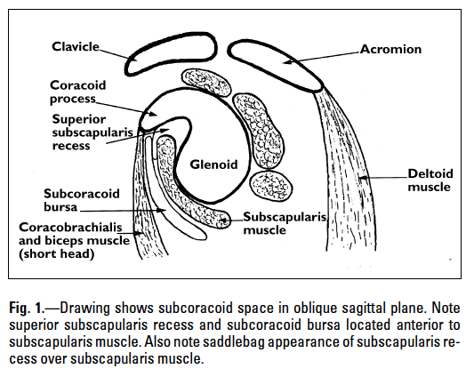 MedView Medical Imaging Consultancy Info Page: Shoulder Bursitis