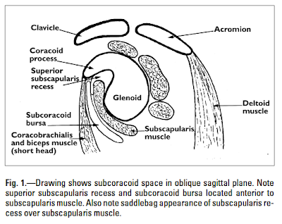 MedView Medical Imaging Consultancy Info Page: Shoulder Bursitis
