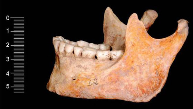 Being Human: Cavemens teeth