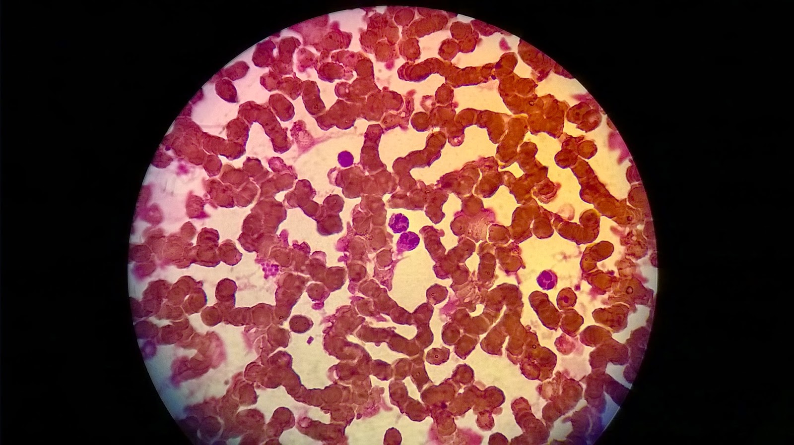 Cuaderno de prácticas de hematologia: Tinción de Wright (13 de Noviembre de 2014)