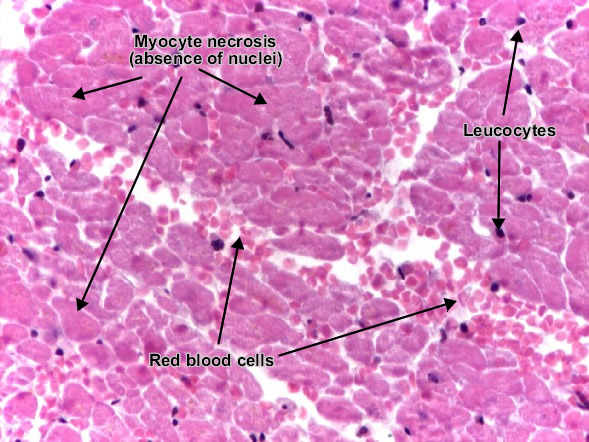 موقع الدكتور أحمد كلحى: صور باثولوجى - ﻿Patholgy Slides ...