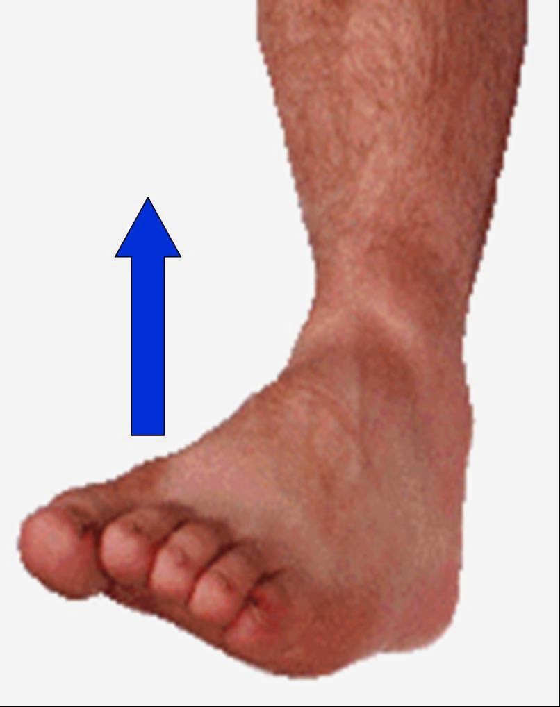 Biomecanica y ortopedia del pie