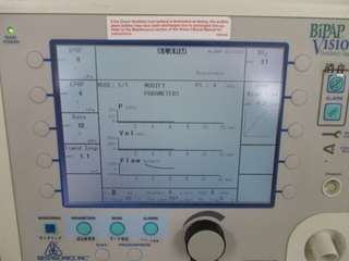 NPPV S/Tモードの設定項目の意味は？詳細解説！-臨床工学技士による呼吸療法勉強会