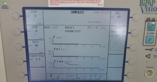NPPV S/Tモードの設定項目の意味は？詳細解説！-臨床工学技士による呼吸療法勉強会