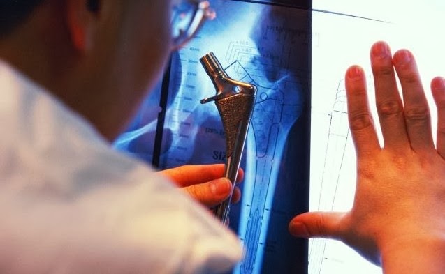 Revisões de Próteses da Anca - Enfermagem em Ortopedia