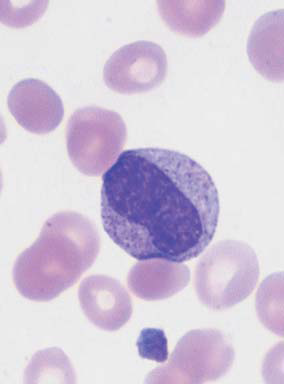 VETERINARY HEMATOLOGY DEXTERVET: metamyelocyte