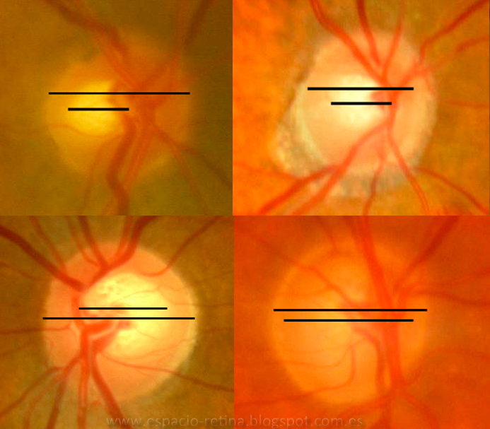 ESPACIO RETINA: enero 2012